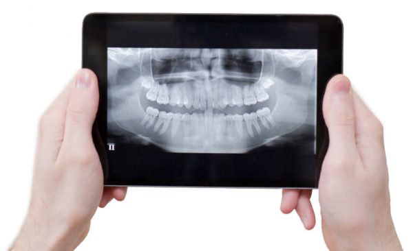 Cleanings, X-Rays & Deep Cleanings | Just Smilez Dental